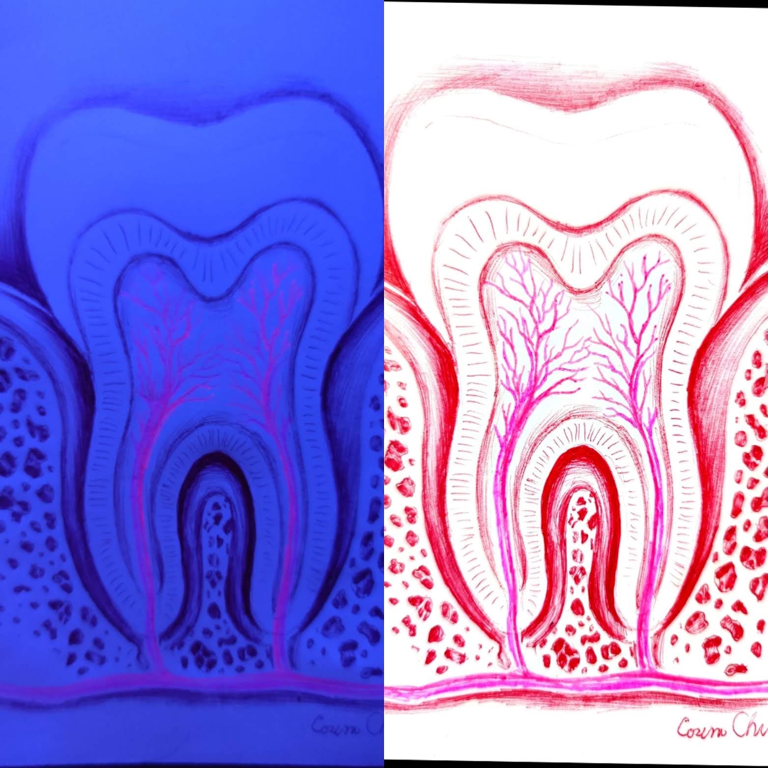 Structura unui dinte – Desene si picturi de Corina Chirila